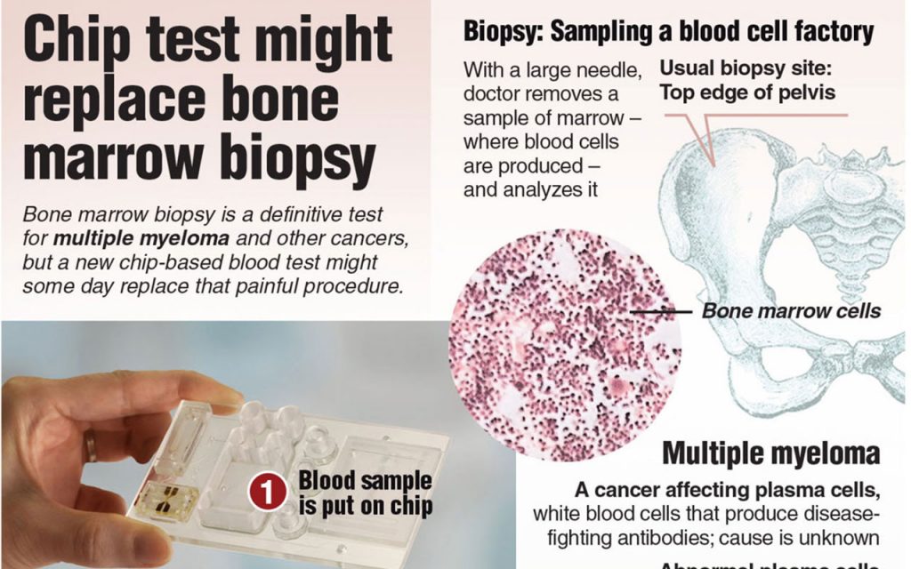 Did You Know? - Chip test might replace bone marrow biopsy | TechNation